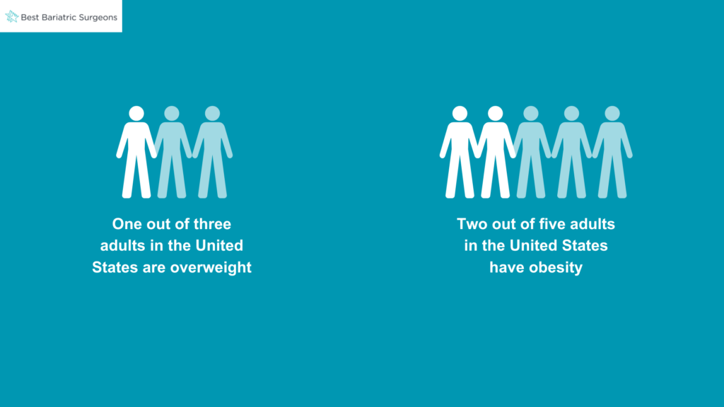 Obesity and Overweight Statistics - Best Bariatric Surgeons
